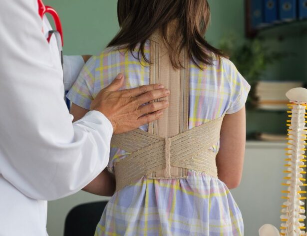 Dextroscoliosis: Right-sided Spinal Curvature | Scoliosis Doctor, Tampa FL